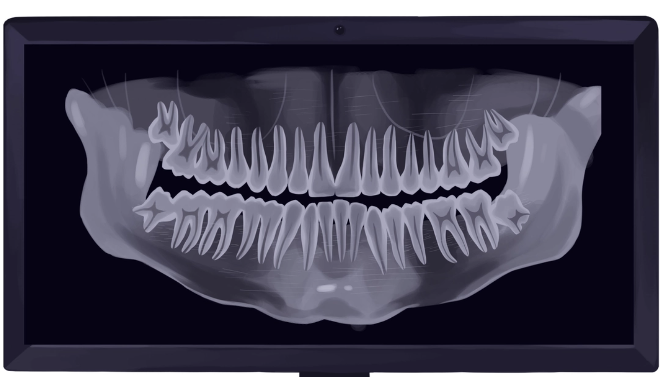 Comprehensive Exam + Digital X-Rays | Custom Veneers for $699